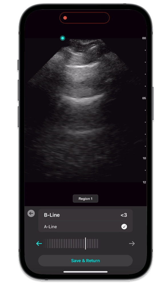 Exo Iris has Arrived