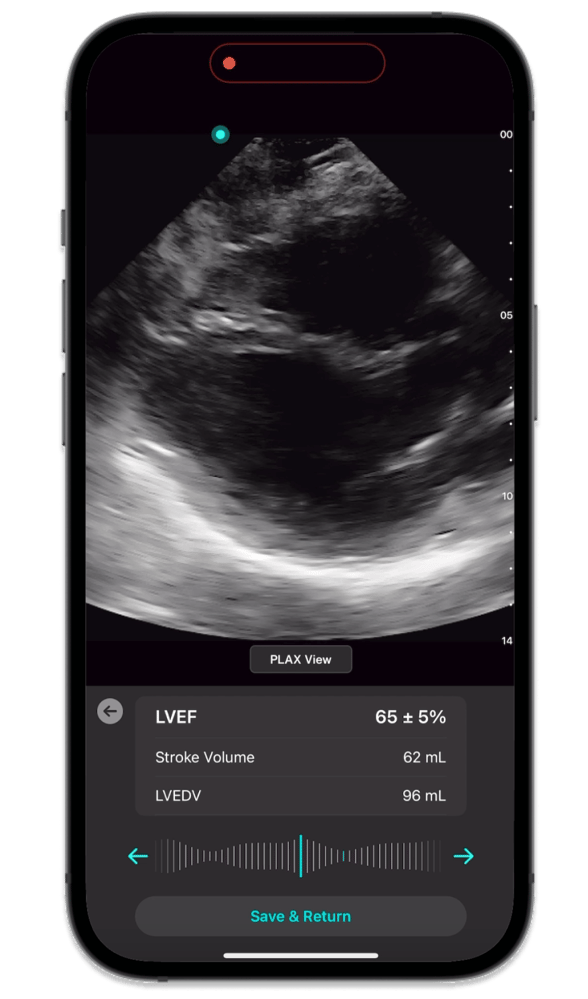 Exo Iris has Arrived