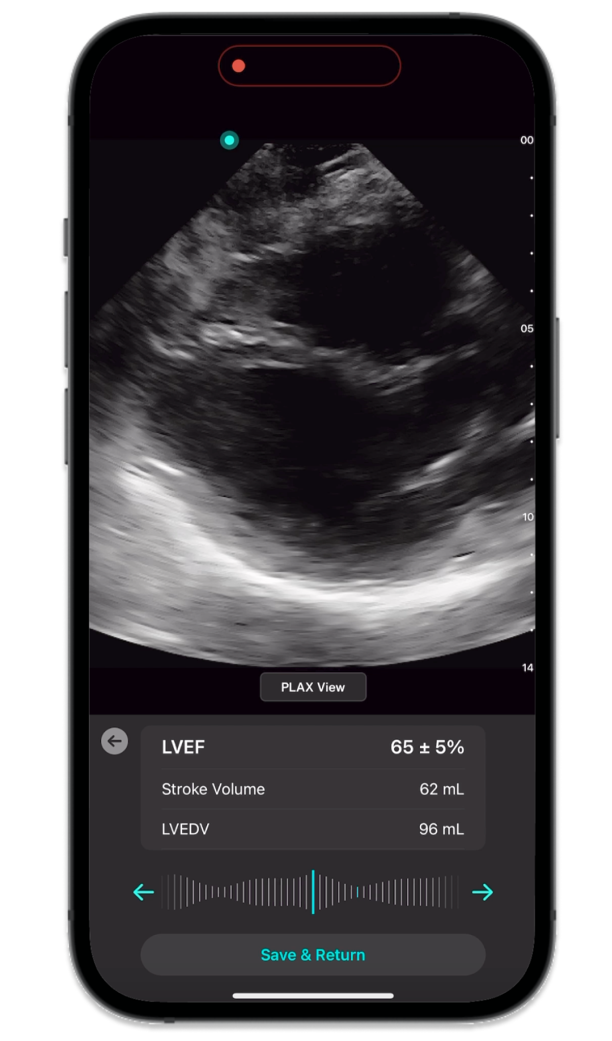 Exo Iris has Arrived