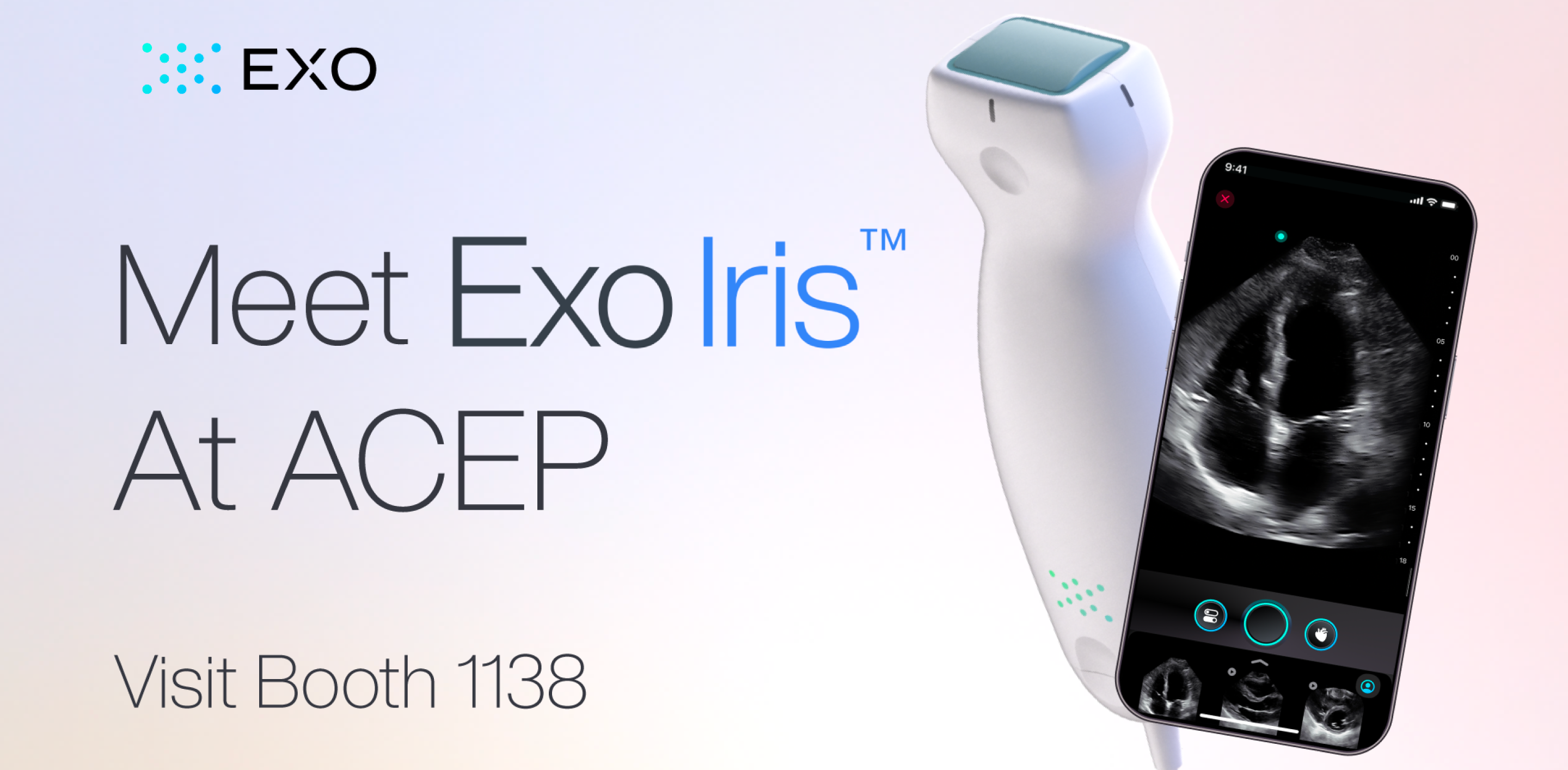 Meet Exo Iris™: A New Age of Ultrasound